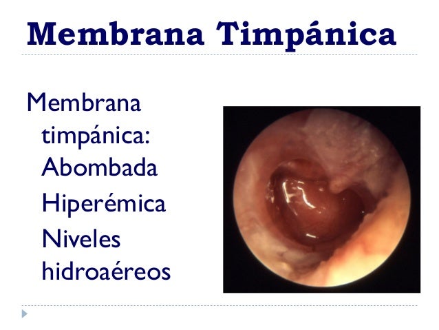 FISIOPATOLOGIA: Neumologia