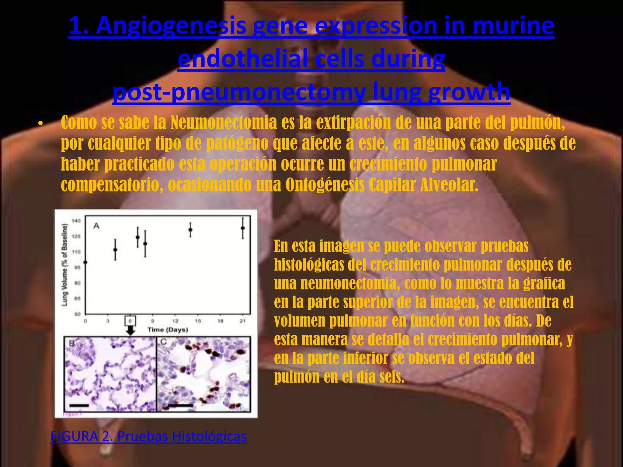 Neumonectomia. Yeison Alexander Millan Montañez semestre I Medicina | PPTX