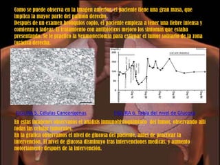 Neumonectomia. Yeison Alexander Millan Montañez semestre I Medicina | PPTX