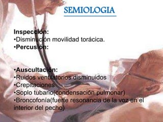 Neumonia | PPTX