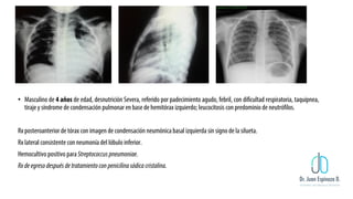 neumonia.pdf | Lung and Respiratory Health | Diseases and Conditions