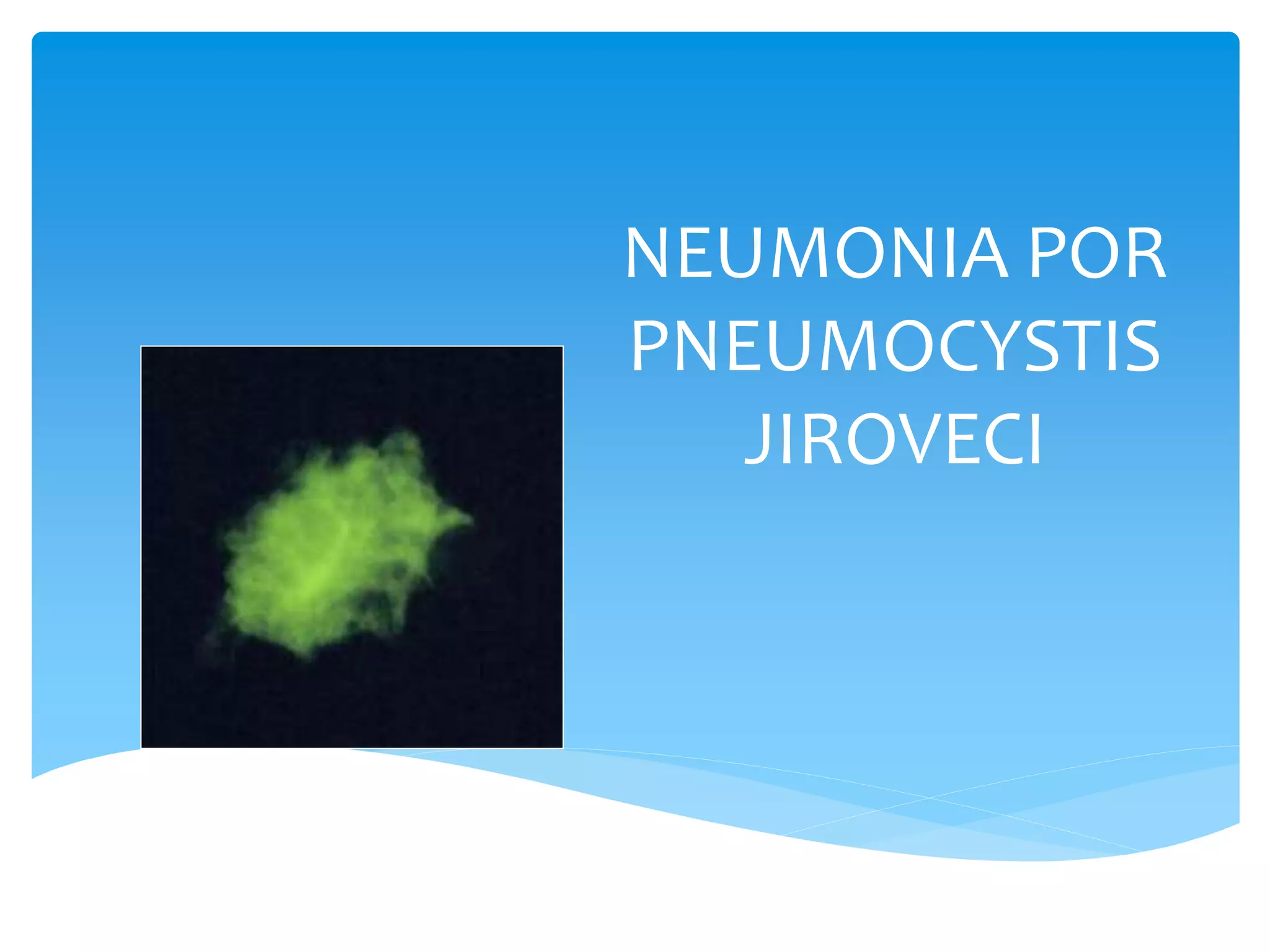 Neumonia por pneumocystis jiroveci | PPTX