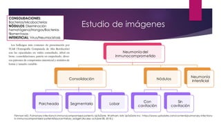 Neumonia en inmunocomprometidos | PDF