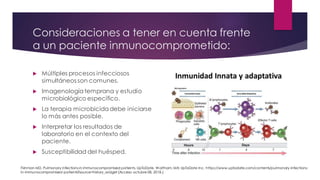 Neumonia en inmunocomprometidos | PDF