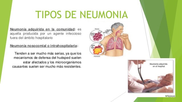 Neumonia