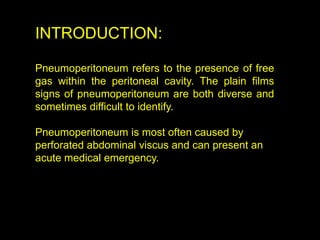 Neumoperitoneo | PPT