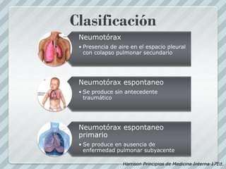 NEUMOTORAX | PDF