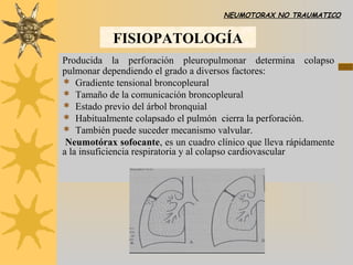Neumotorax | PPT