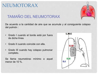 Neumotorax | PPT