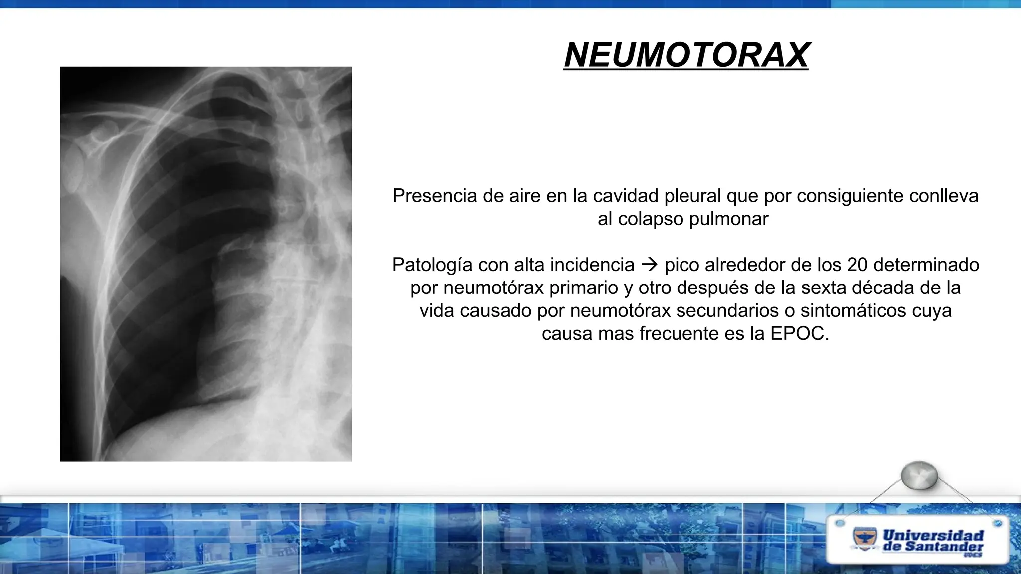 NEUMOTORAX-456, copia y descripción interesante | PDF | Lung and ...