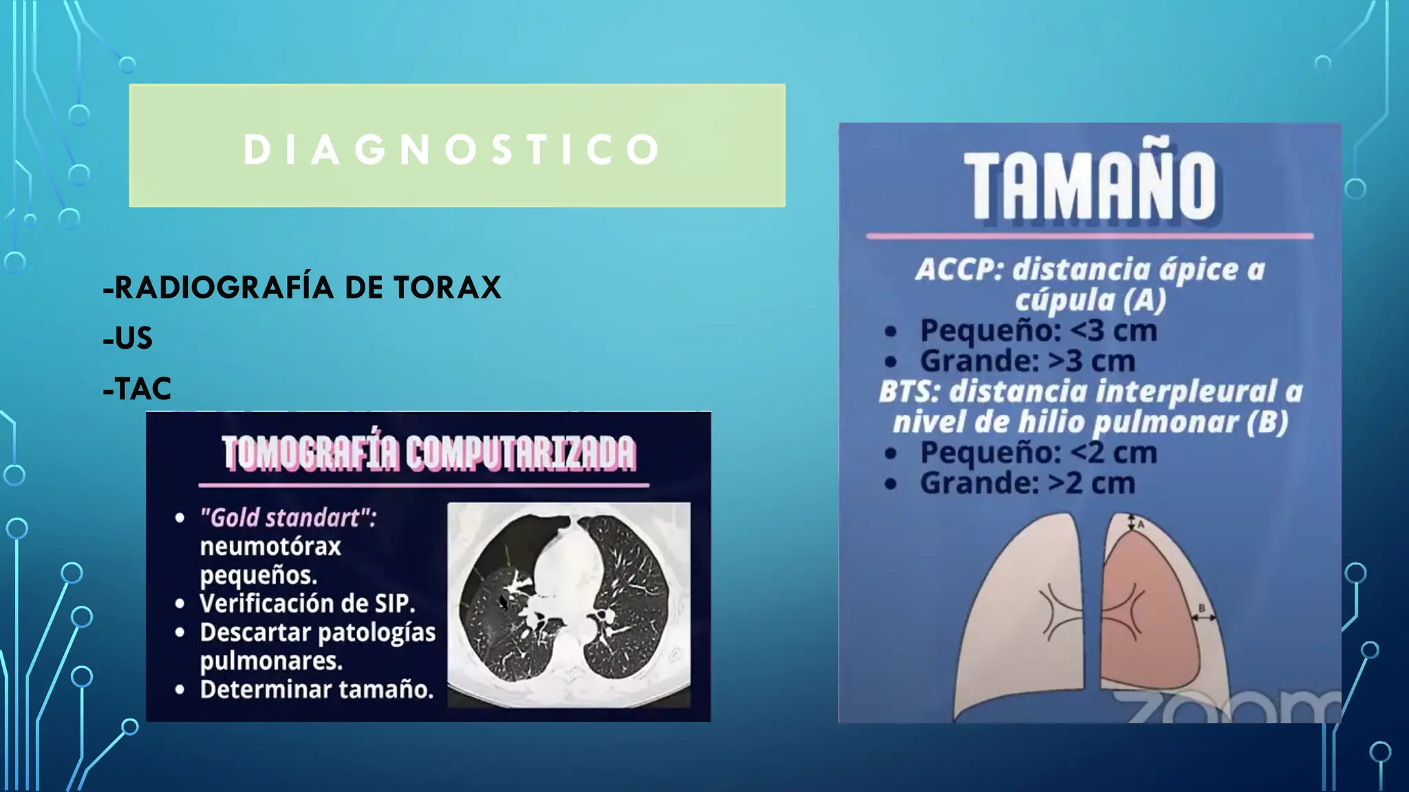 neumotorax clasificación de grados en urgencias. | PPTX