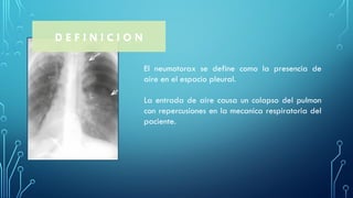 neumotorax clasificación de grados en urgencias. | PPTX