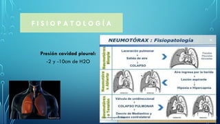 neumotorax clasificación de grados en urgencias. | PPTX