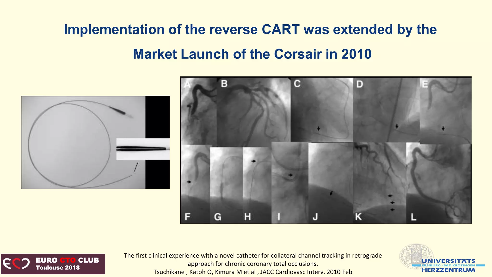 Reverse CART techniques: conventional, directed, extended, assisted … | PPT