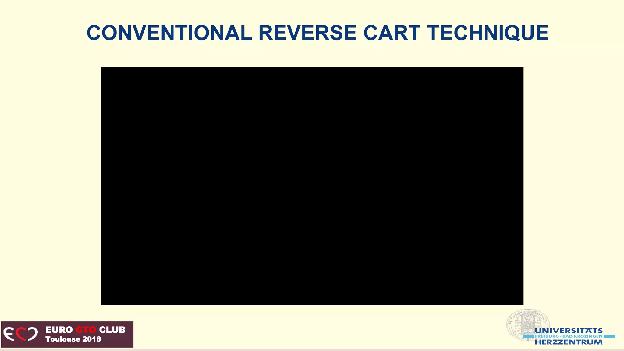 Reverse CART techniques: conventional, directed, extended, assisted … | PPT