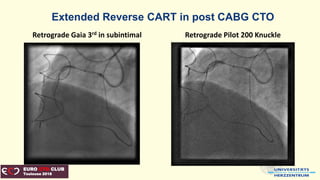 Reverse CART techniques: conventional, directed, extended, assisted … | PPT