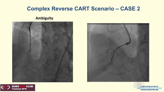 Reverse CART techniques: conventional, directed, extended, assisted … | PPT