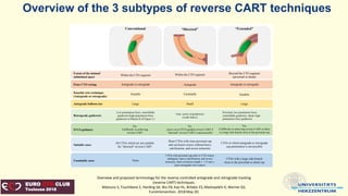 Reverse CART techniques: conventional, directed, extended, assisted ...