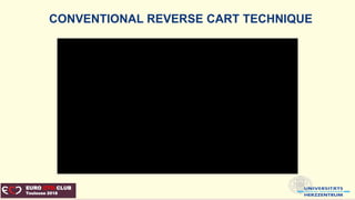 Reverse CART techniques: conventional, directed, extended, assisted … | PPT