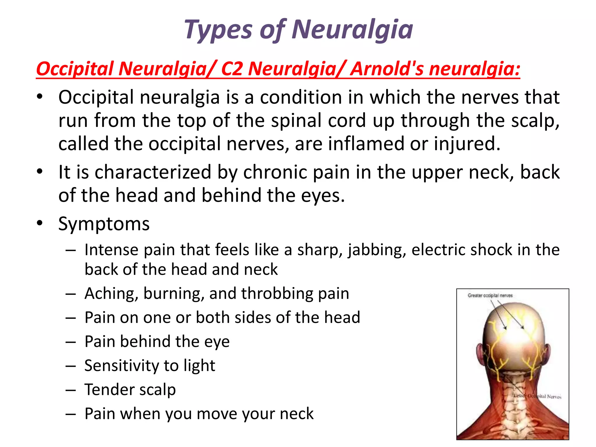 Neuralgia | PPTX