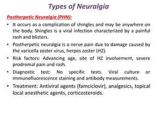 Neuralgia | PPTX