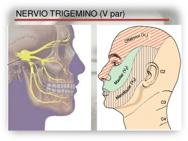 Neuralgia del trigemino