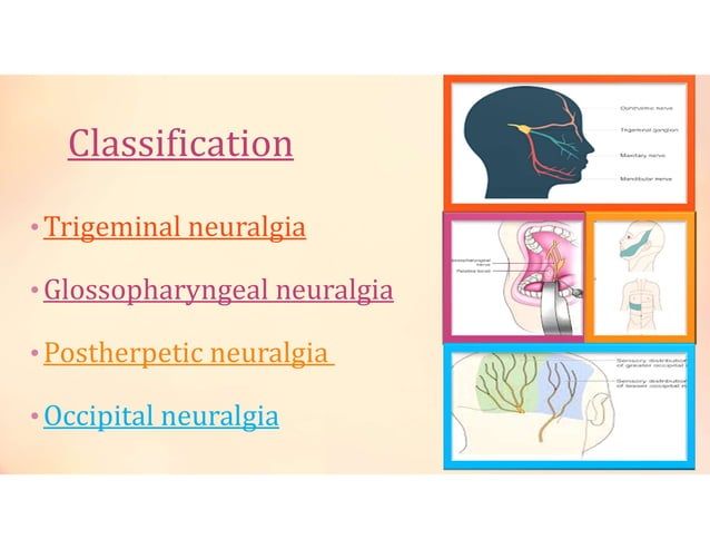 NEURALGIA PPT .pdf | Brain and Nervous System Disorders | Diseases and ...