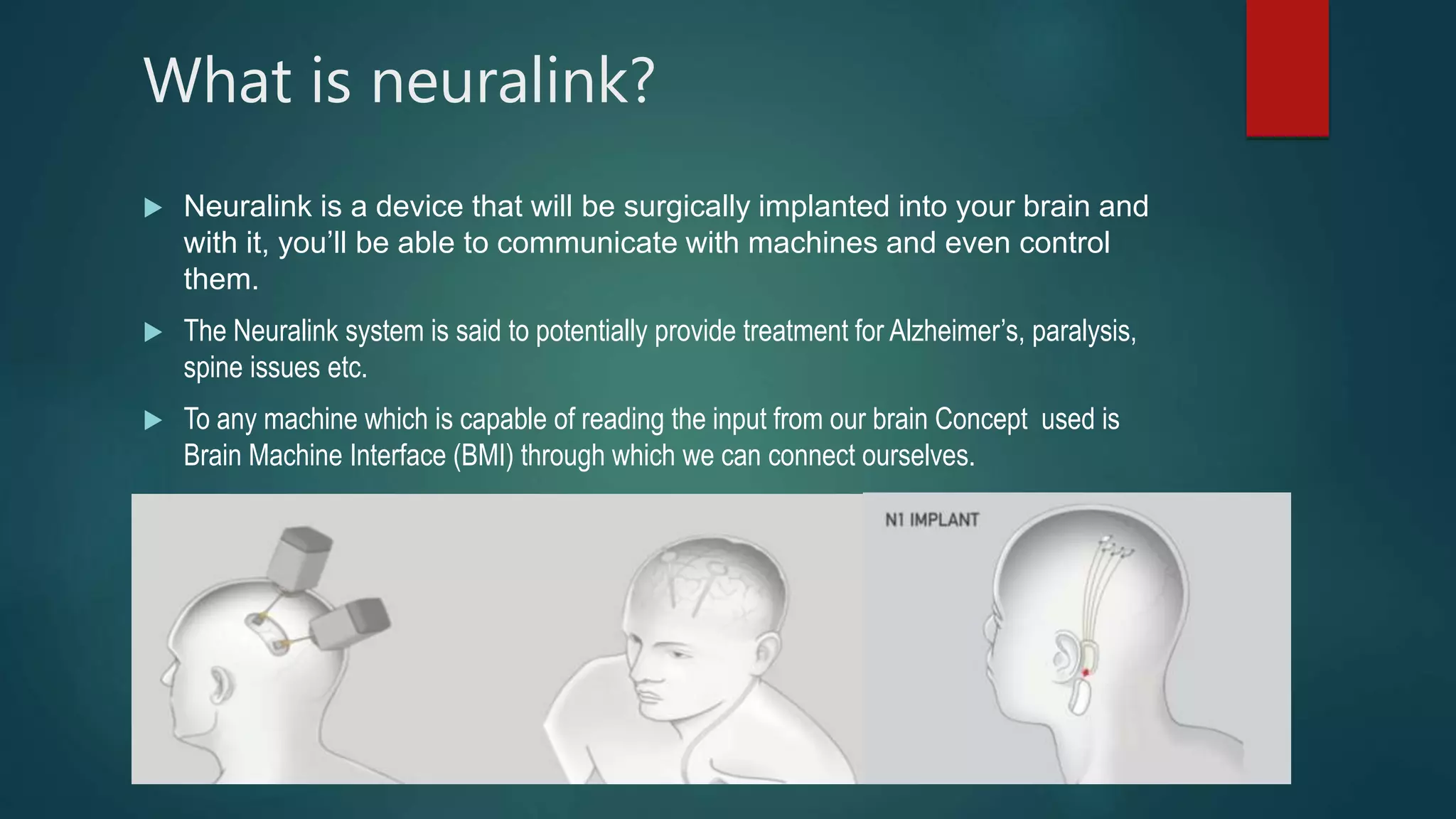 Neuralink | PPTX