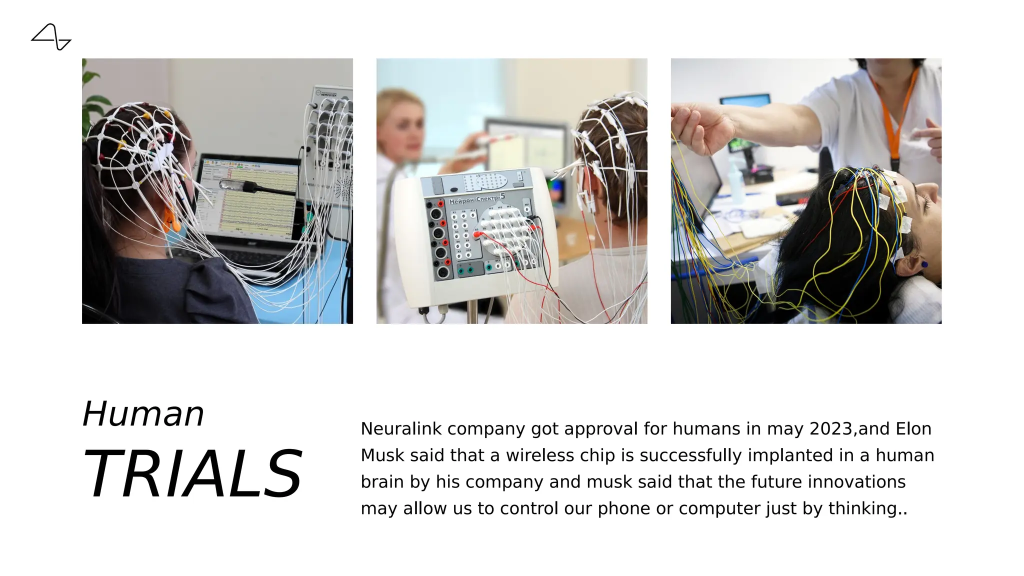 Neuralink technology which was about the inserting chips in brain | PDF