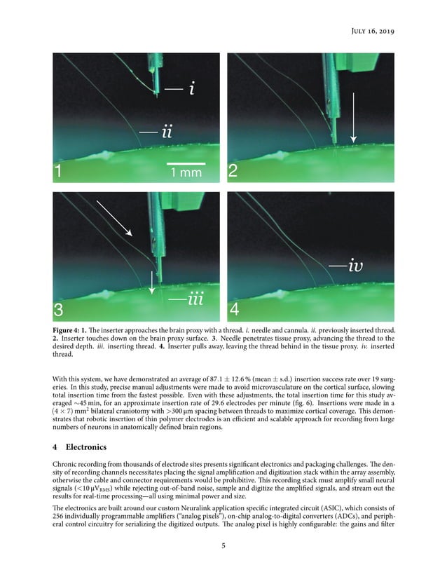 Neuralink white-paper. Elon Musk & Neuralink | PDF