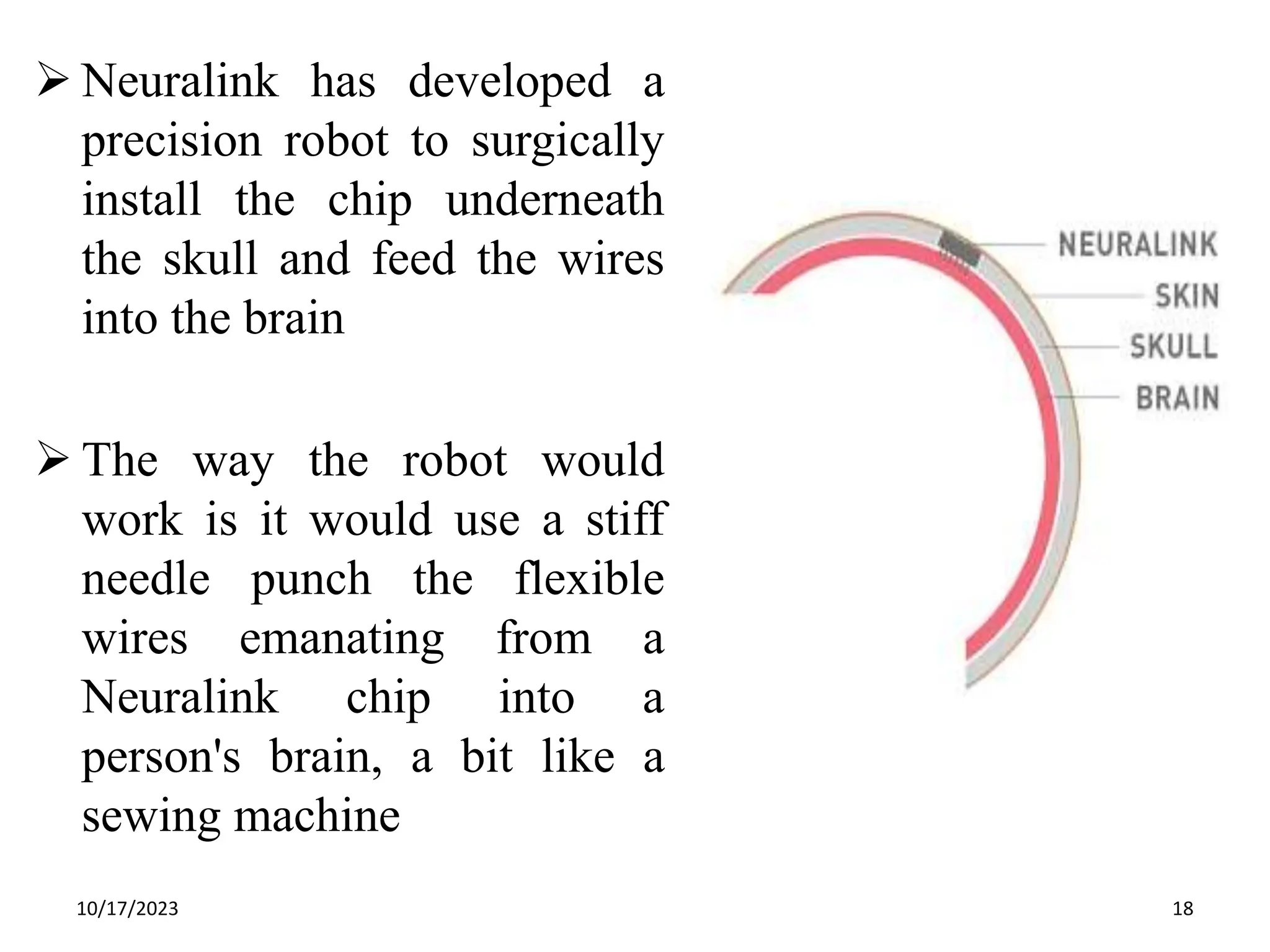 NEURALINK presentation.pptx