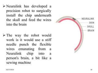 NEURALINK presentation.pptx