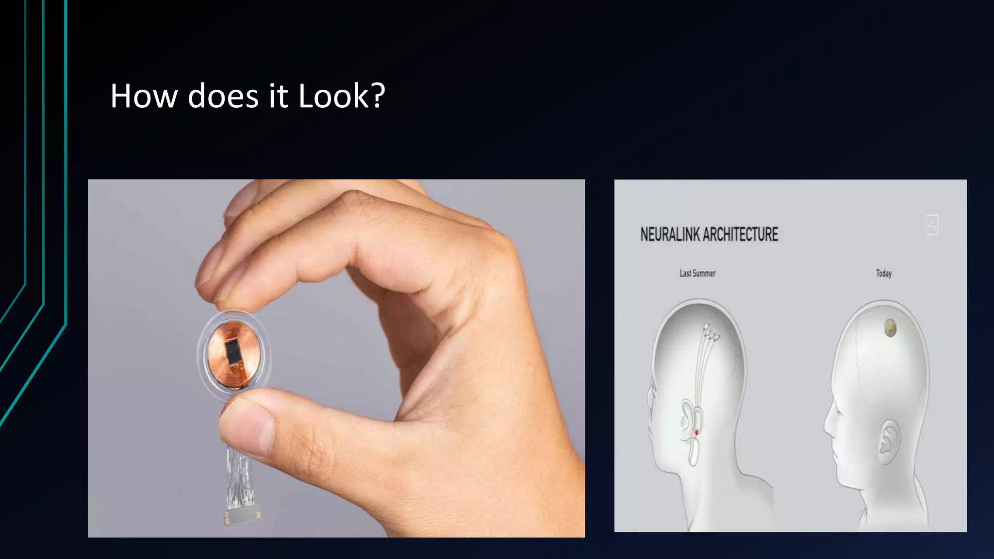 Neuralink technical seminar | PPTX