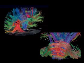 Neural interfaces | PDF