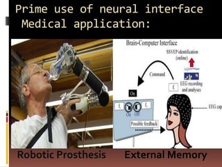 Neural interfacing | PPTX