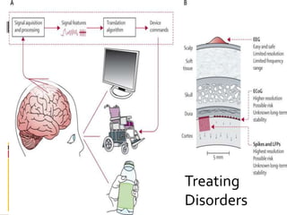Neural interfacing | PPTX