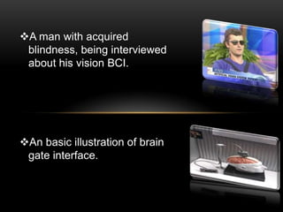 Neural interfacing | PPTX