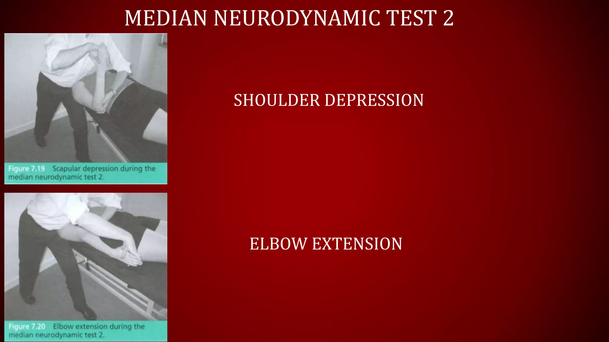 Neural tissue mobilization Upper Limb Assessment | PPTX
