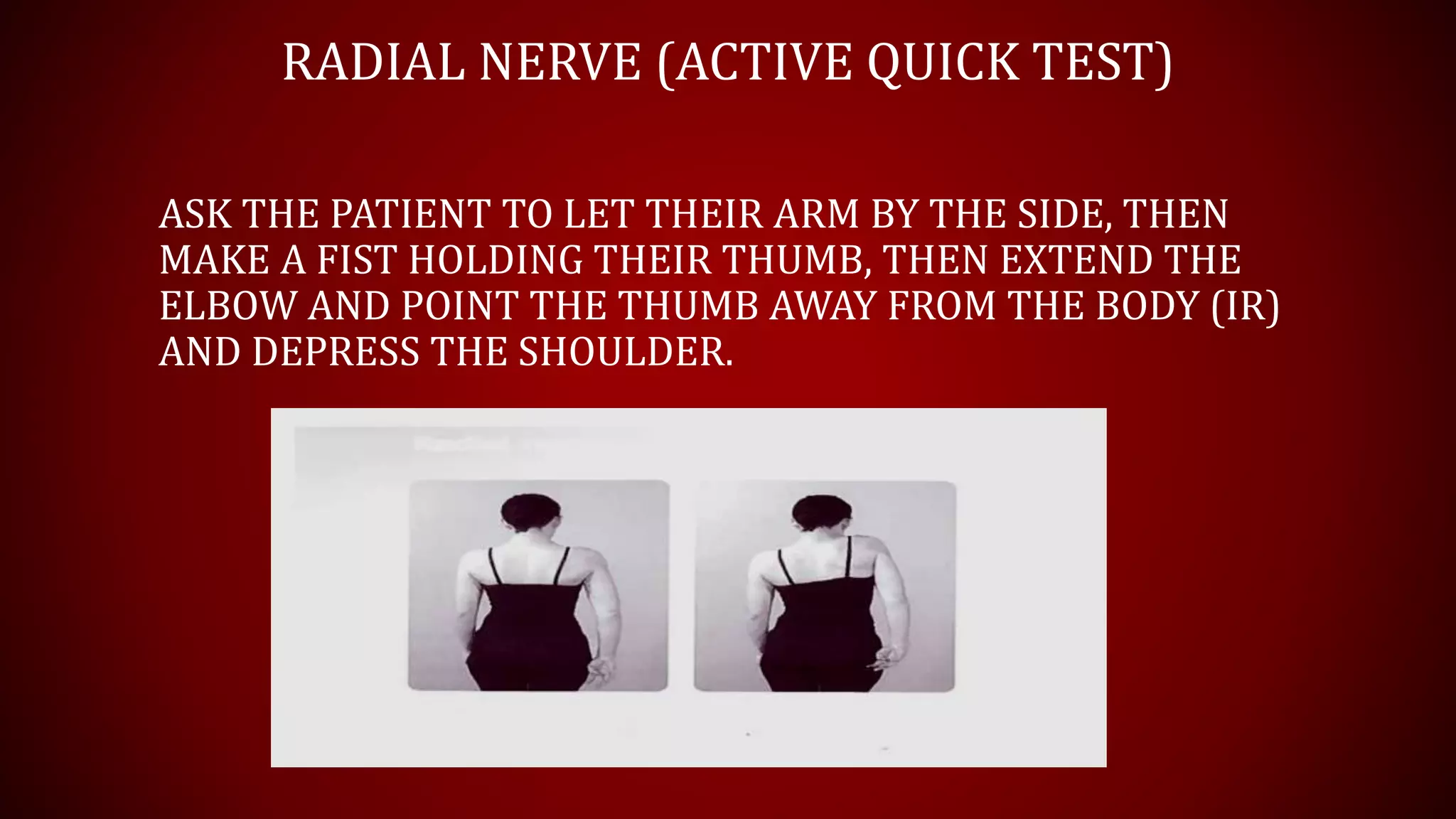Neural tissue mobilization Upper Limb Assessment | PPTX