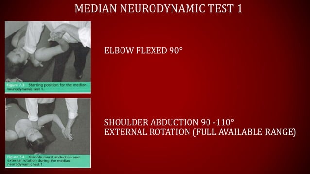 Neural tissue mobilization Upper Limb Assessment | PPTX | Brain and ...