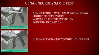 Neural tissue mobilization Upper Limb Assessment | PPTX
