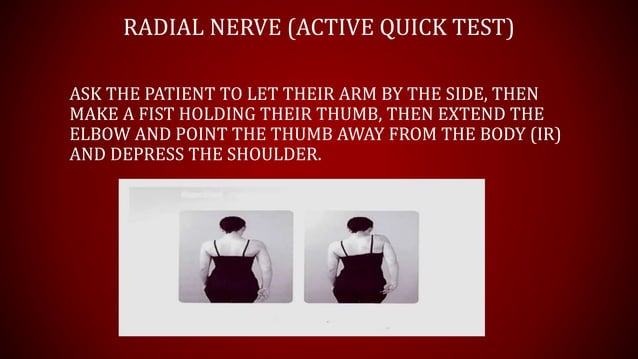 Neural tissue mobilization Upper Limb Assessment | PPTX | Brain and ...