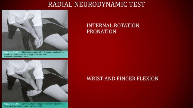 Neural tissue mobilization Upper Limb Assessment | PPTX | Brain and ...