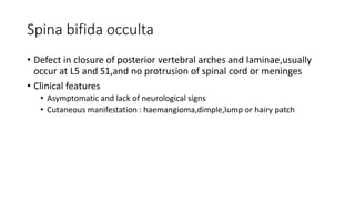 Neural tube defect | PPT