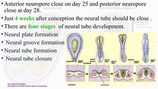 NEURAL TUBE DEFECT pptx | PPTX