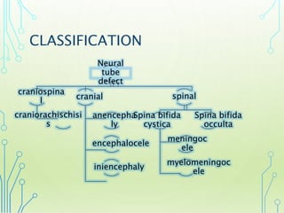 Neural tube defect | PPTX