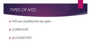 Neural tube defect [ntd] | PPTX