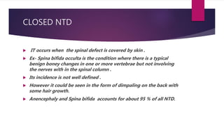 Neural tube defect [ntd] | PPTX
