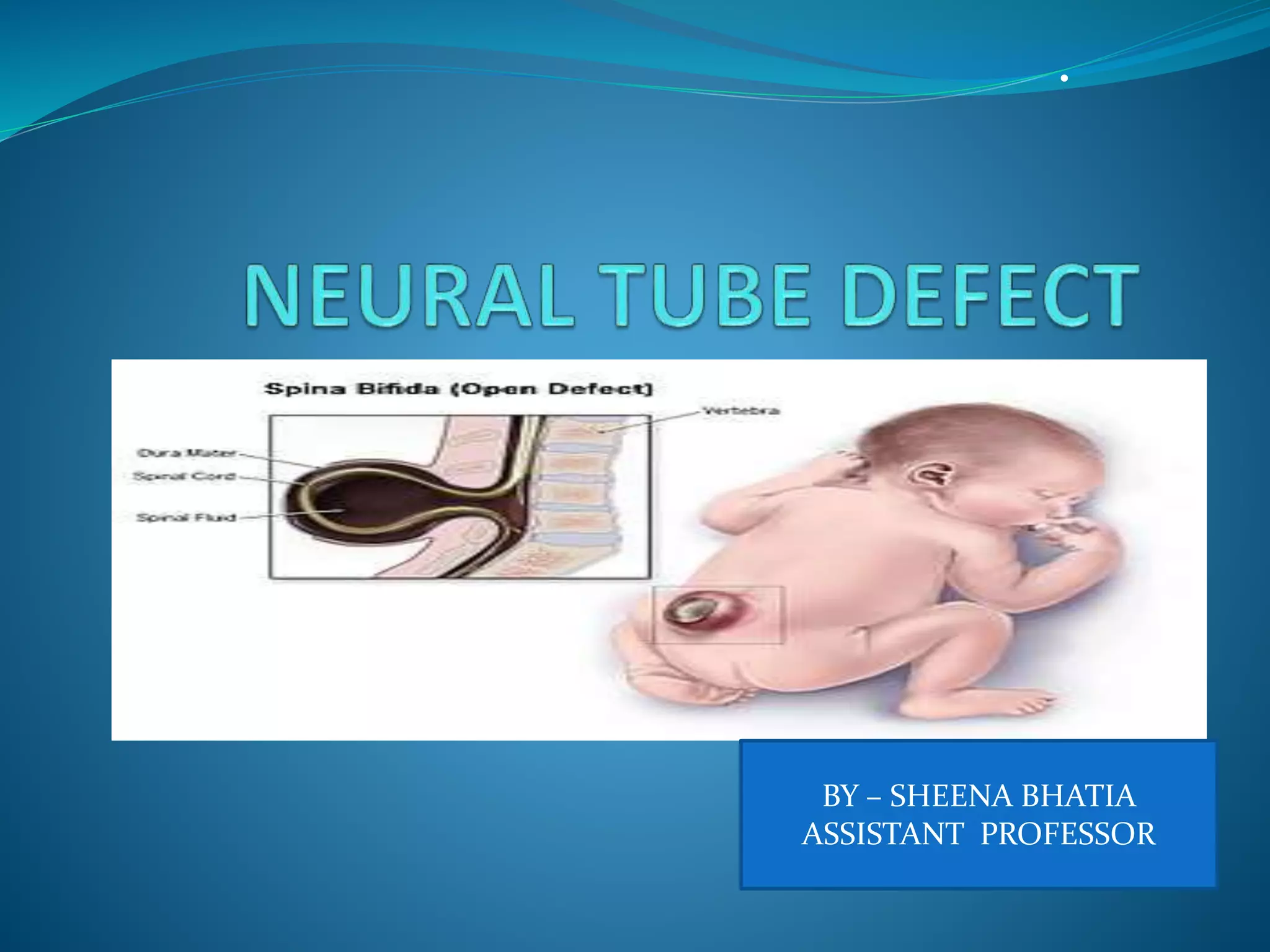 Neural tube defect presentation | PPTX