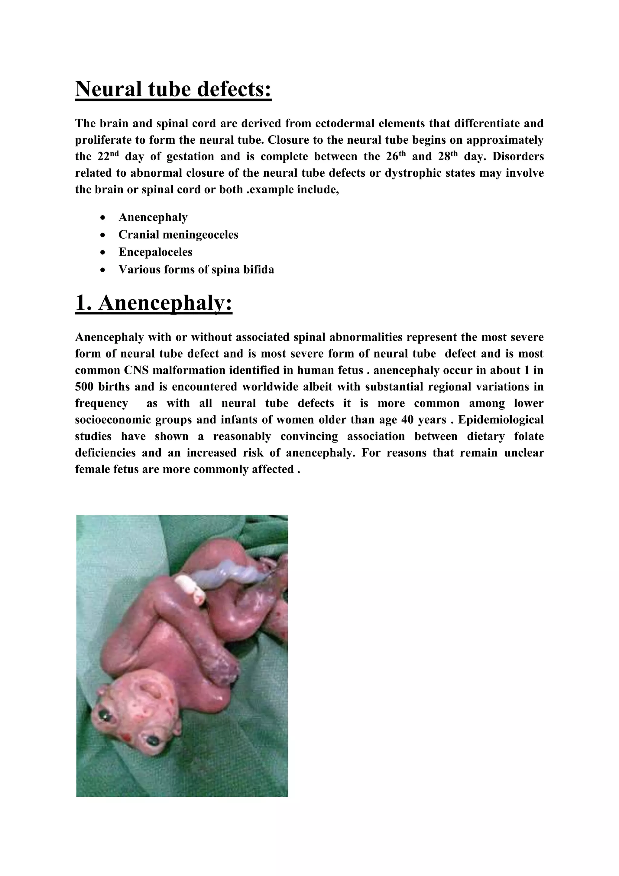 Neural tube defects | DOCX